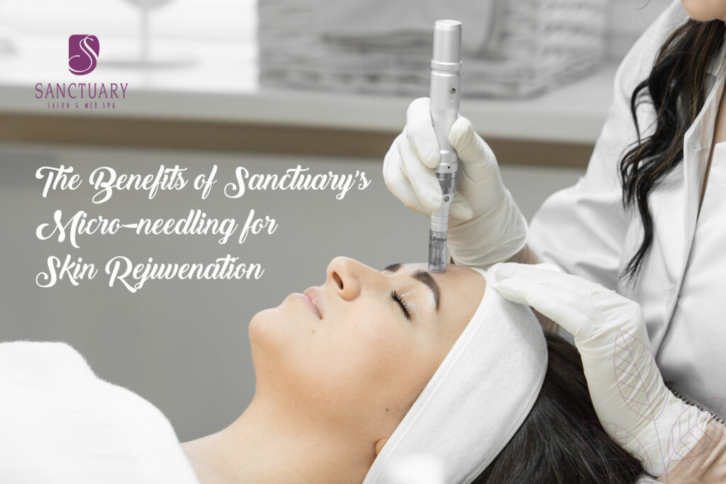Benefits of Sanctuary’s Micro-needling for Skin Rejuvenation